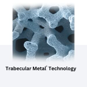 Persona® OsseoTi® Keel Tibia - Medizhen