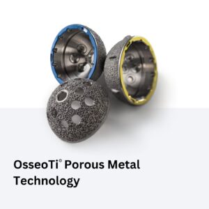 Persona® OsseoTi® Keel Tibia - Medizhen